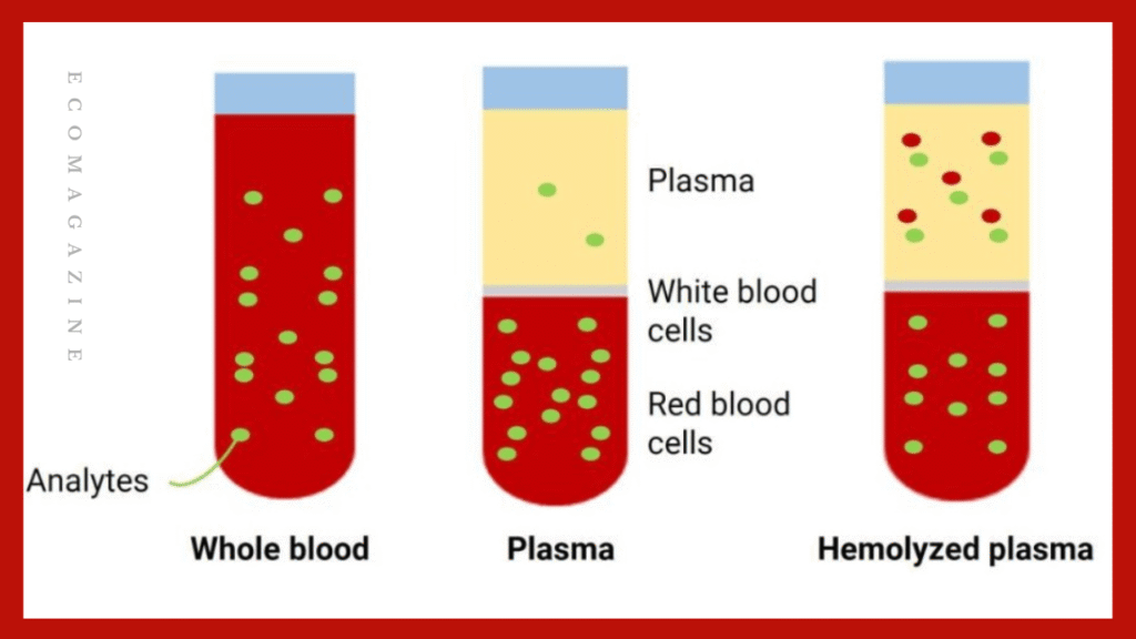 Why Hemolyzed Blood Samples Skew Laboratory Results